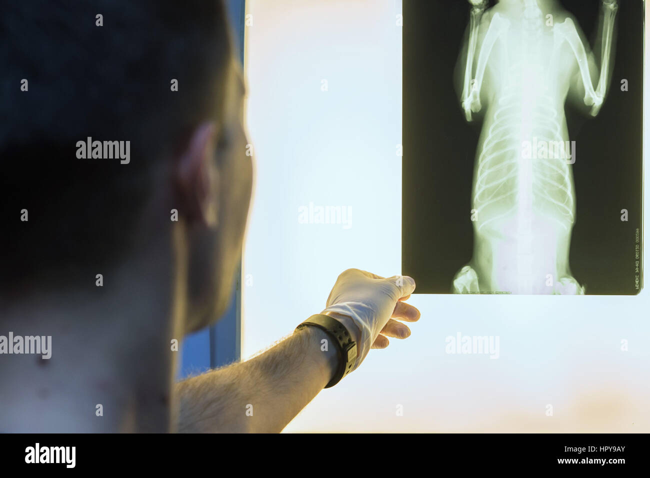 Skeleton x ray healthy abdomen hi-res stock photography and images - Alamy