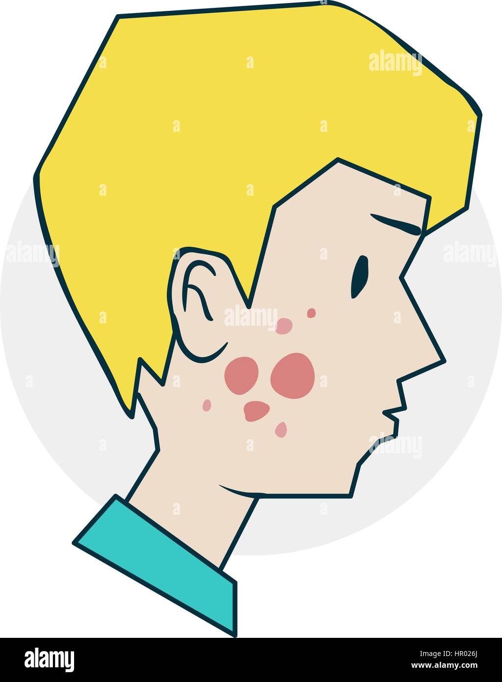 Acne Illustration Stock Photos & Acne Illustration Stock Images - Alamy