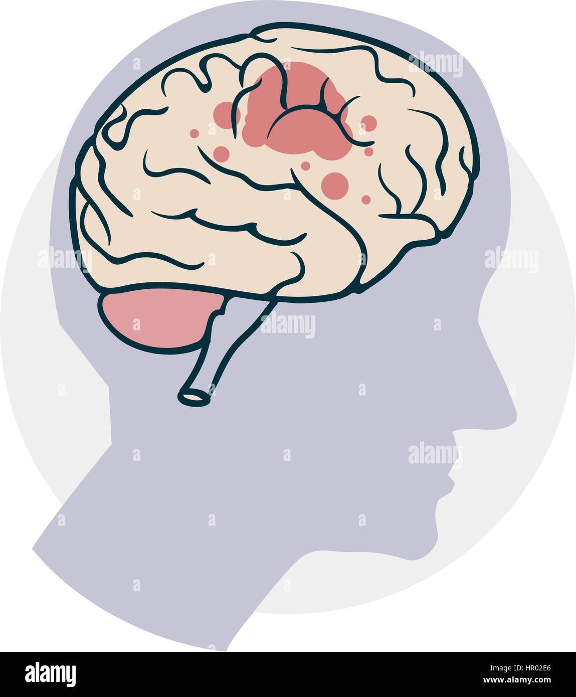 Hemorrhage Stock Vector Images - Alamy