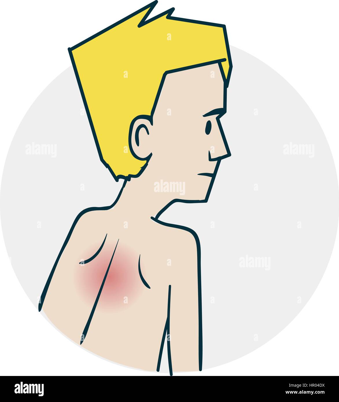 Lower Back Pain Illustration Stock Photos & Lower Back Pain ...