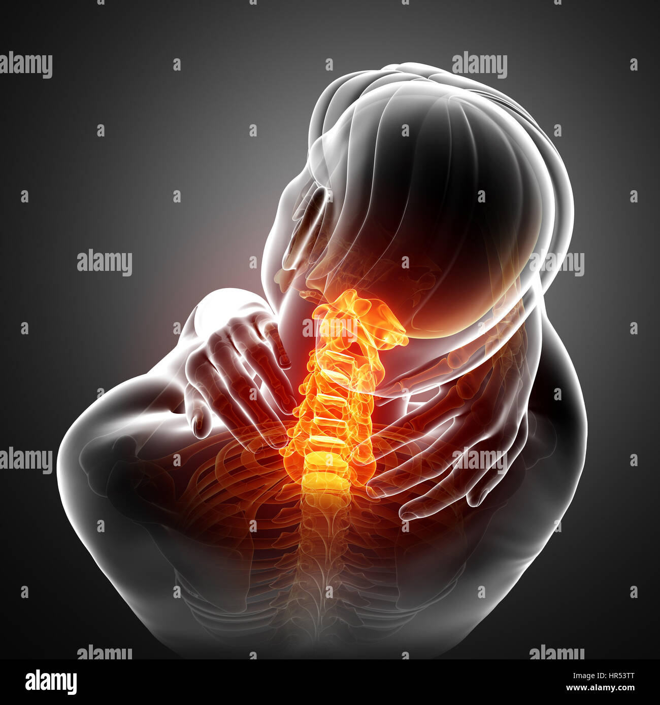 3d Illustration of men Feeling the Neck Pain Stock Photo - Alamy