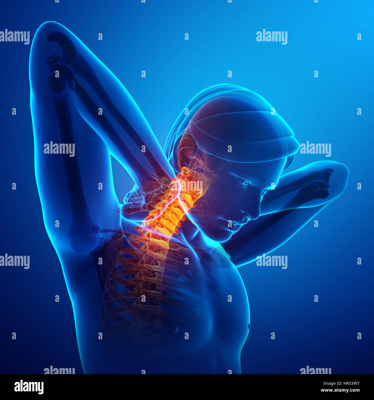 3d Illustration of men Feeling the Neck Pain Stock Photo - Alamy