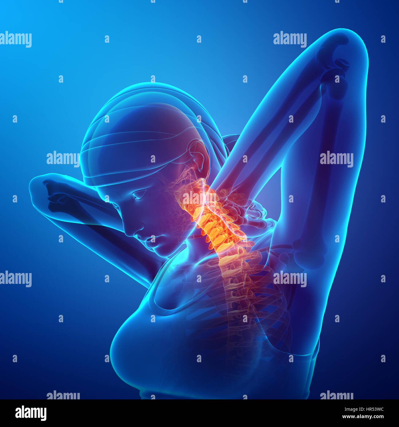 3d Illustration of Women Feeling the Neck Pain Stock Photo - Alamy