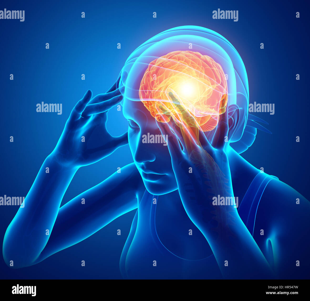 3d Illustration of Women Feeling Headache Stock Photo - Alamy