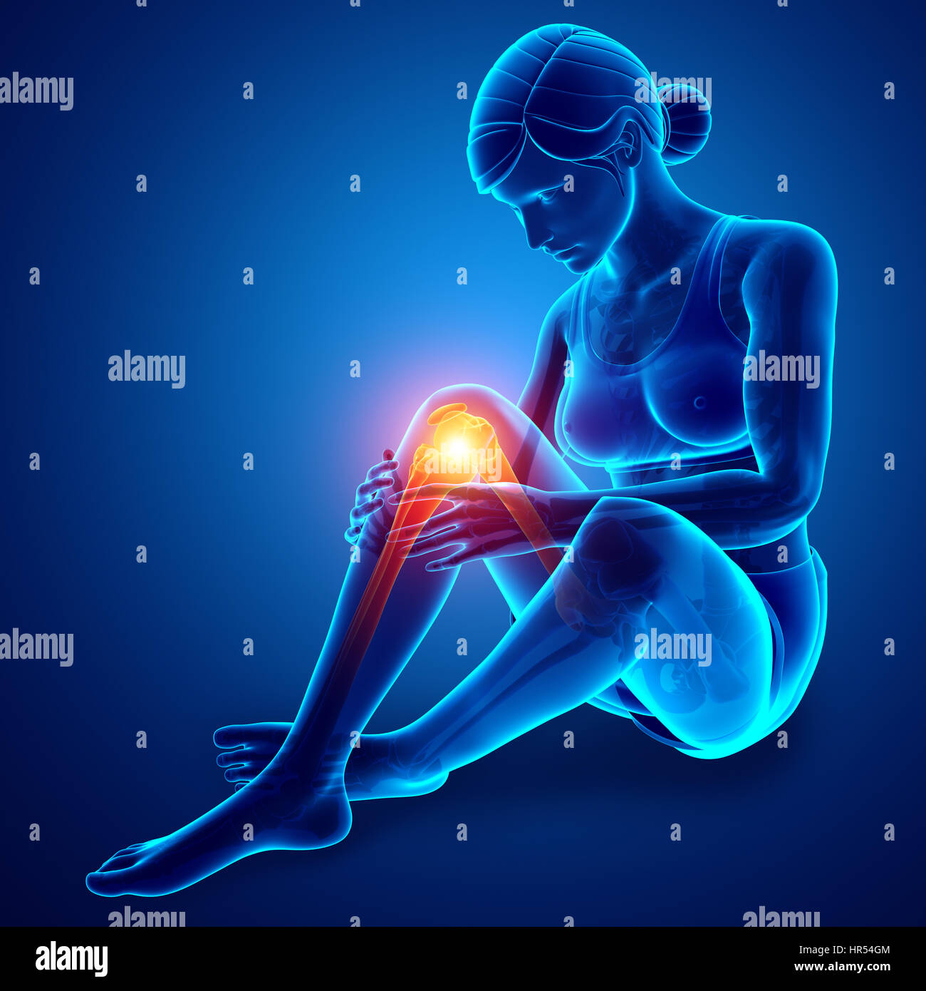 3d Illustration of Women Knee pain Stock Photo - Alamy