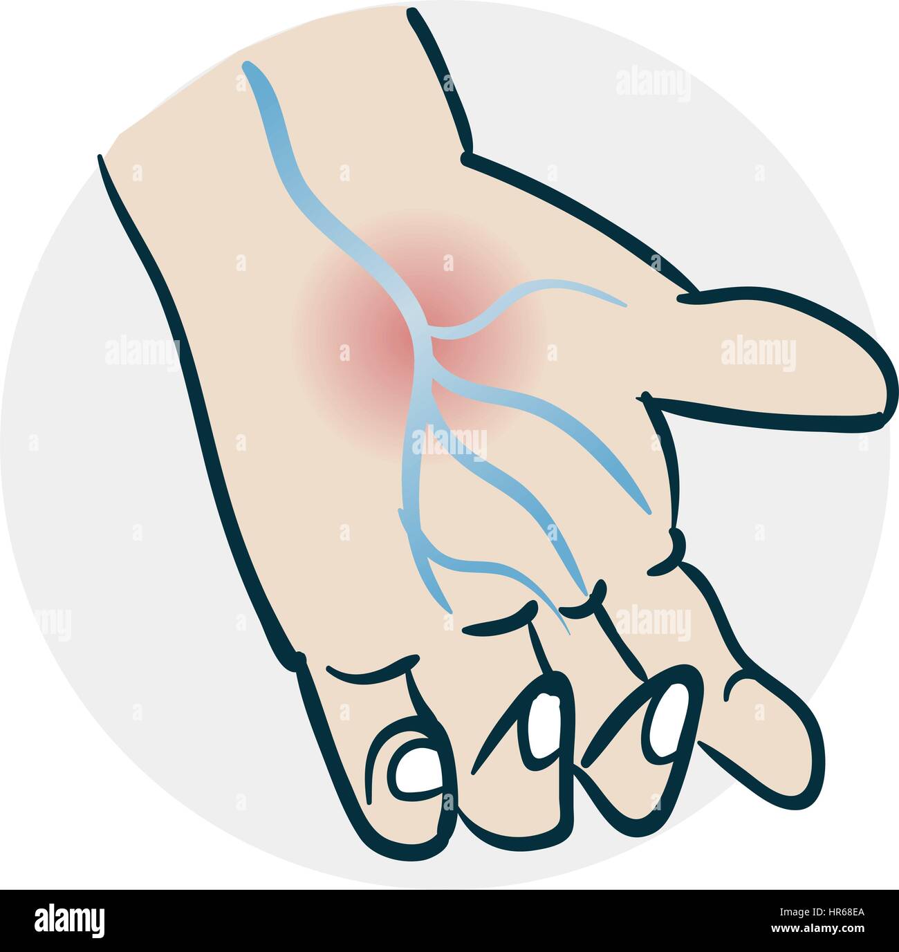 problems with veins hands icon. Illustration of a funny cartoon style ...