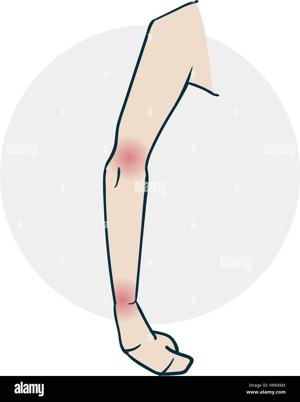 Problems with the limb joints. Illustration of a funny cartoon style ...