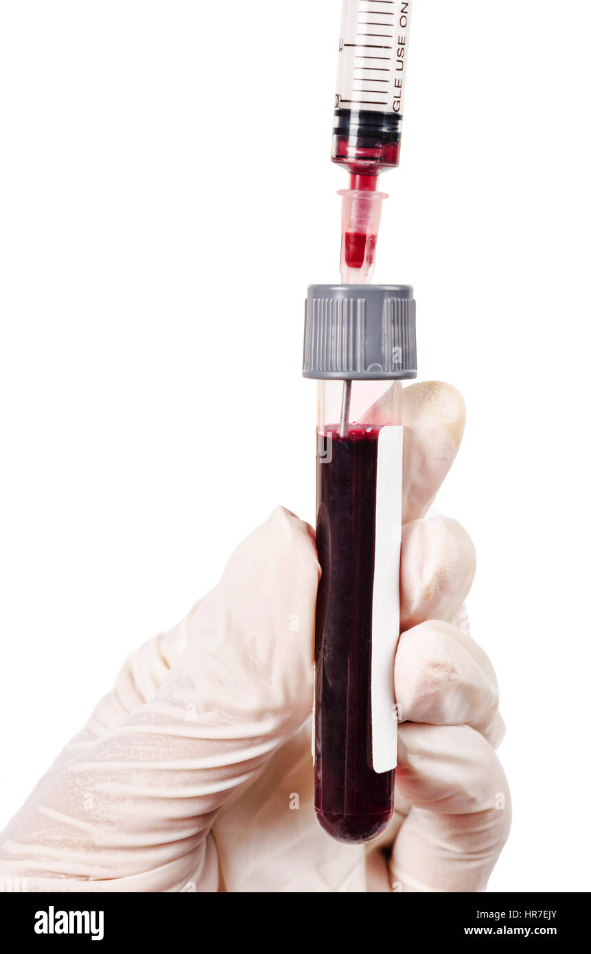 Hand doctor holding sample blood for test into blood tube from needle ...