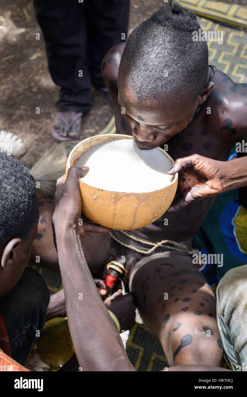 Circumcision Baineann Afraic Circumcision | Dr. Ismaïl ZARROU