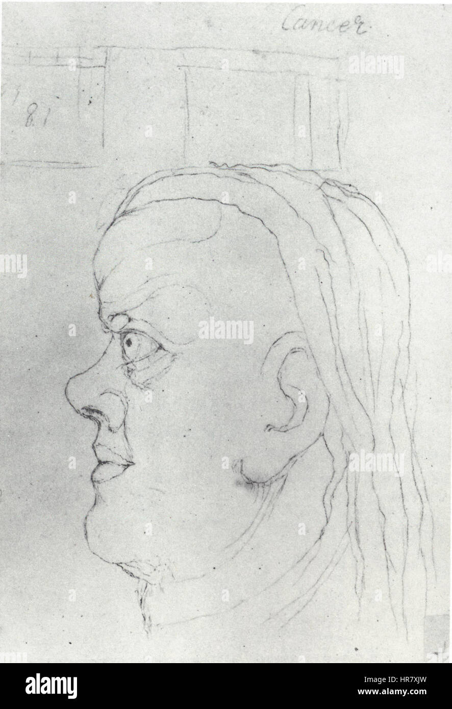 ‘Head of Cancer’ (c.1820) by William Blake is a detailed study of the ...
