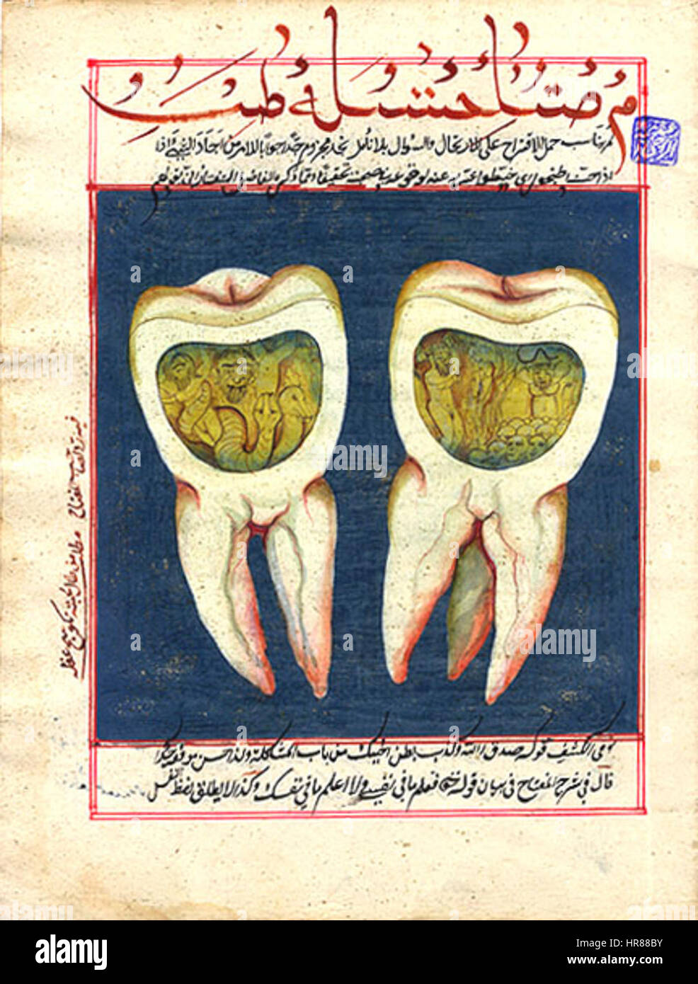 Tooth worm hi-res stock photography and images - Alamy