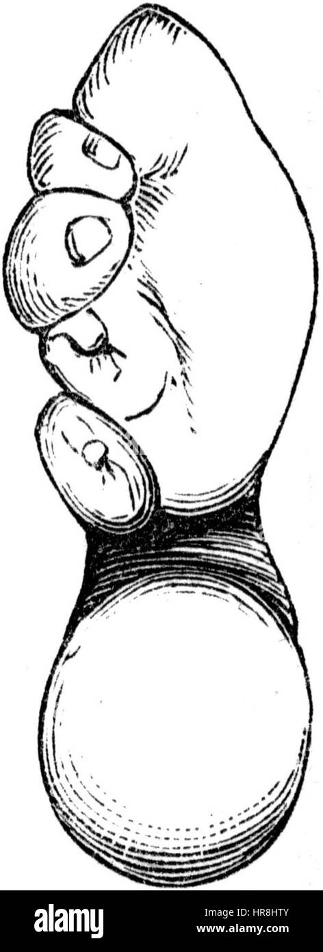 But foot Black and White Stock Photos & Images - Alamy