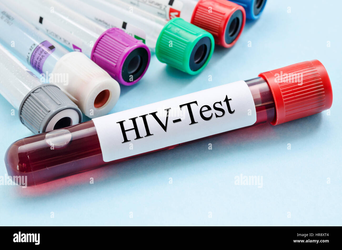 Sample blood collection tube with HIV test label in laboratory Stock ...