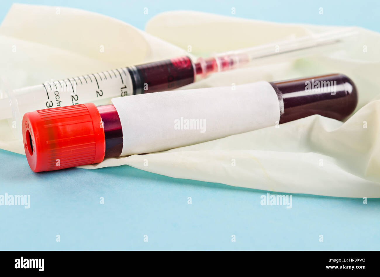Sample blood for screening test and syringe with glove in laboratory ...