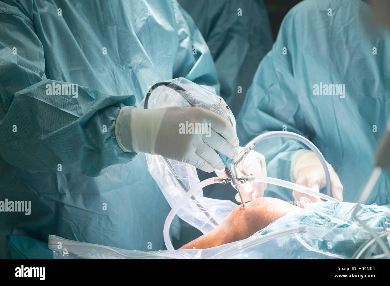 Knee keyhole surgery hospital arthroscopy operation medical procedure ...