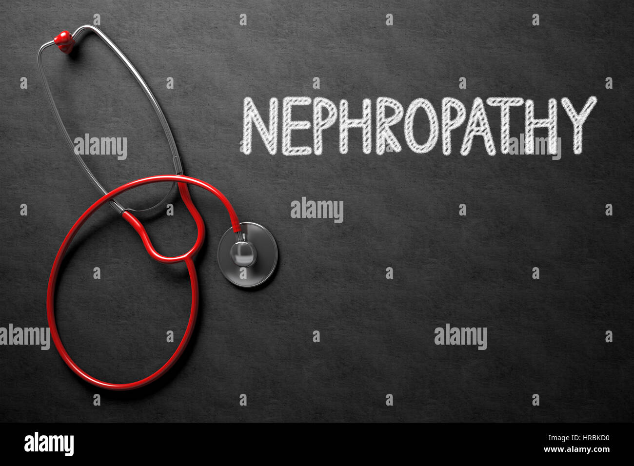 Nephropathy Handwritten on Chalkboard. 3D Illustration Stock Photo - Alamy Nephropathy Handwritten on Chalkboard. 3D Illustration Stock Photo - Alamy