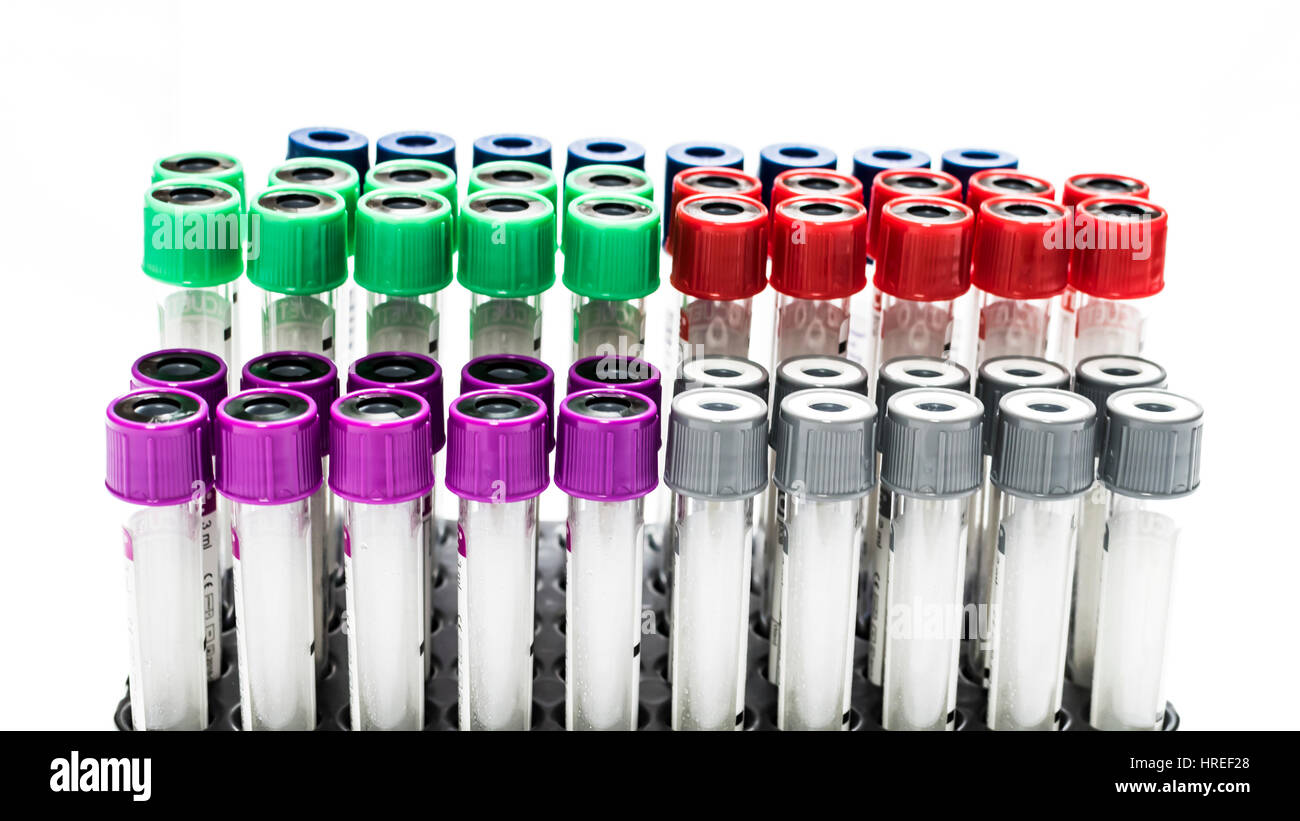 Colorful laboratory tube on the rack Stock Photo - Alamy