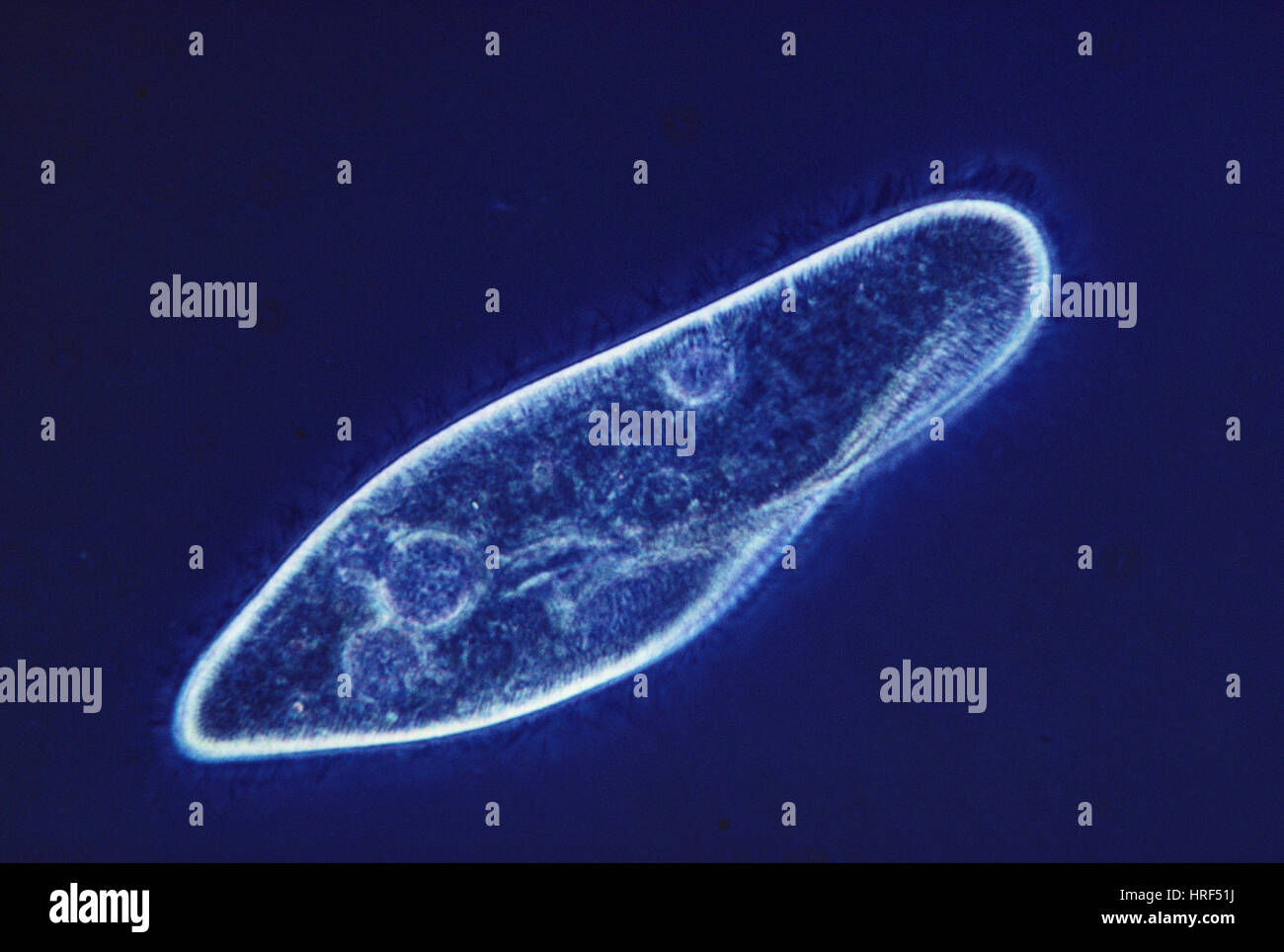 Paramecium protozoa light micrograph hi-res stock photography and ...