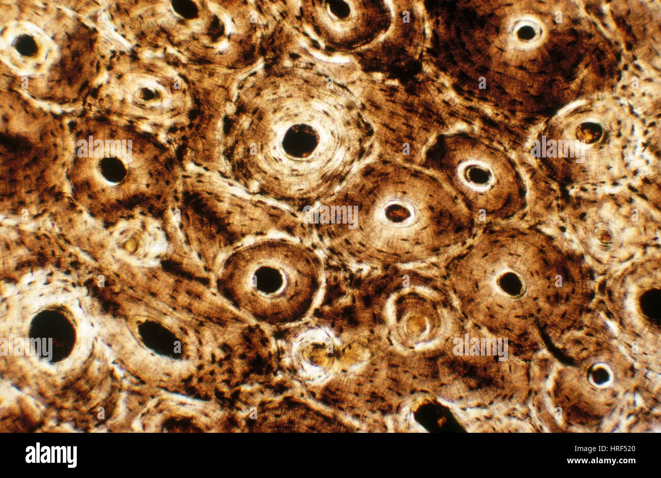 Cross section bone hi-res stock photography and images - Alamy