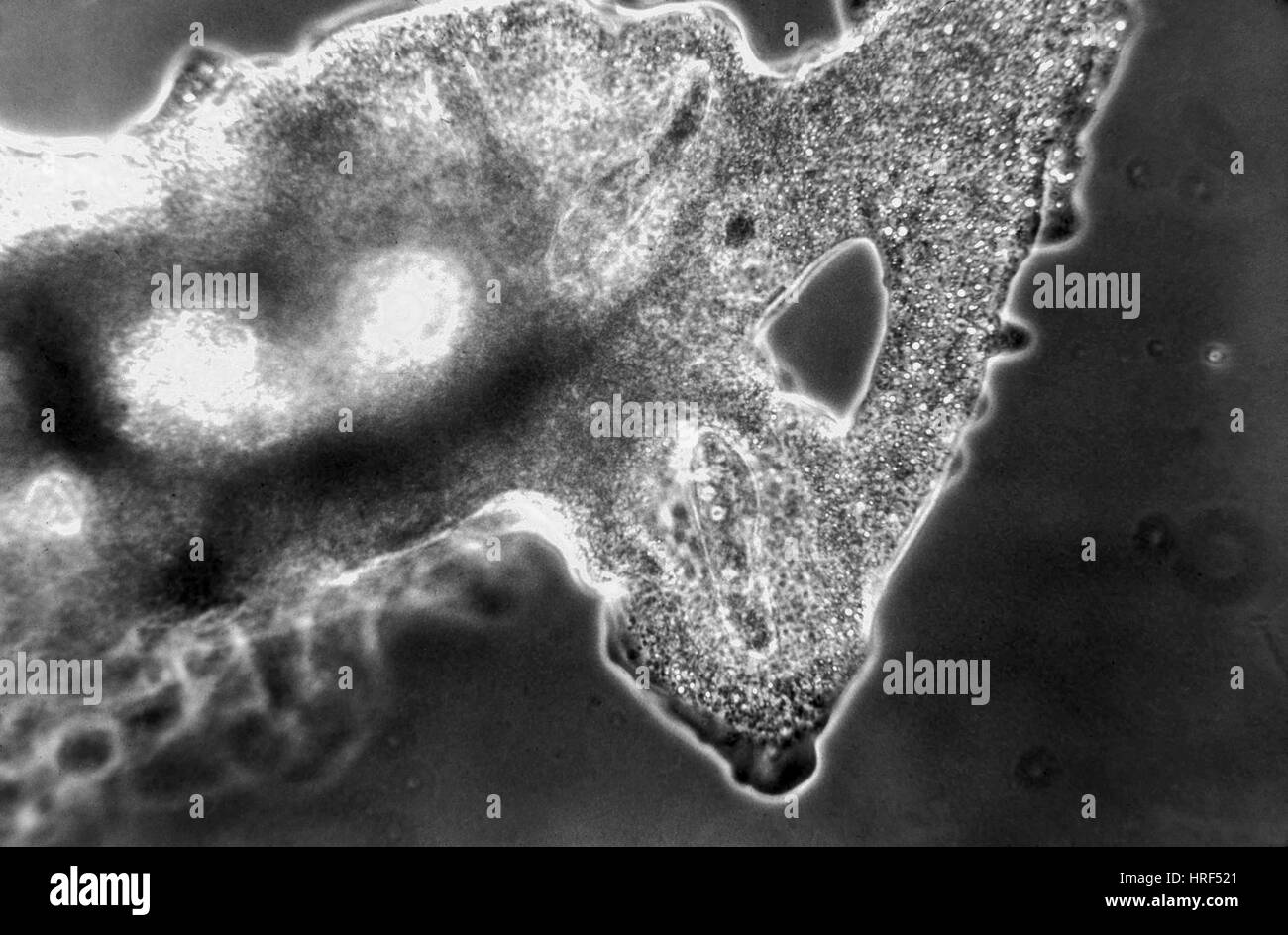 LM of Amoeba Catching Paramecium Stock Photo - Alamy