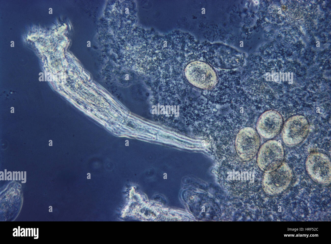 Rotifera hi-res stock photography and images - Alamy