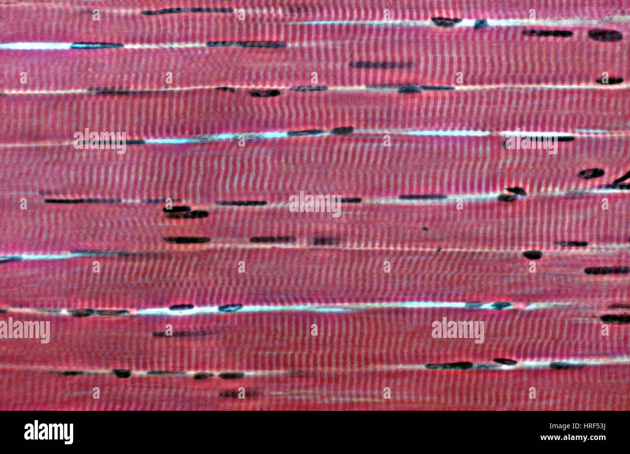 Skeletal Muscle Tissue