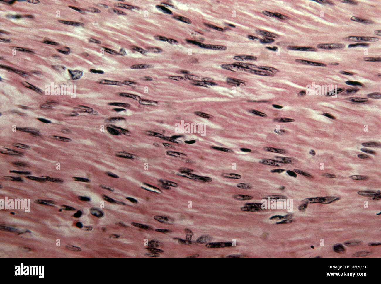 Smooth Muscle Micrograph High Resolution Stock Photography and Images ...