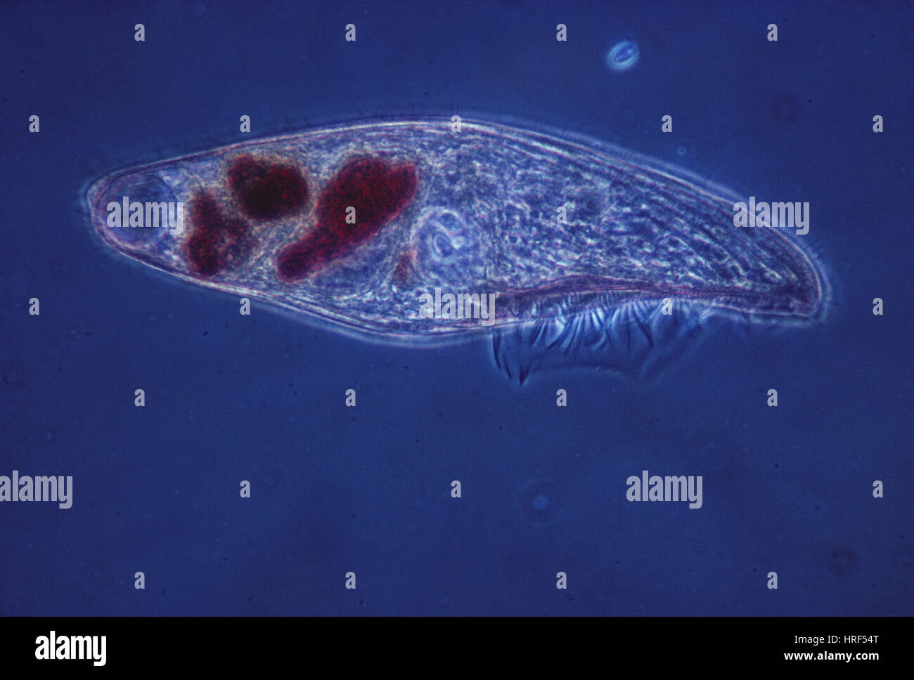 Blepharisma Labeled Diagram