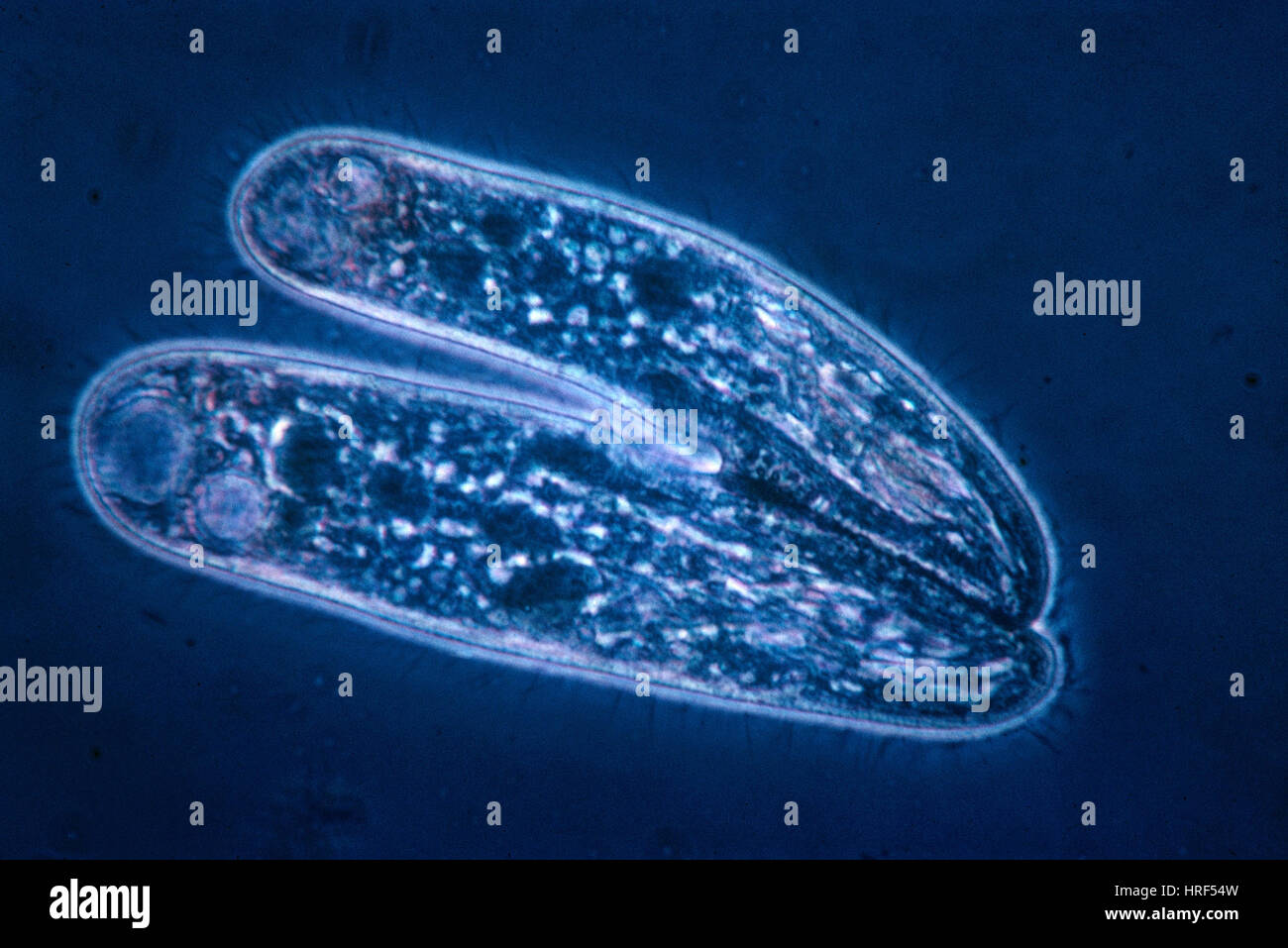 Blepharisma Labeled Diagram