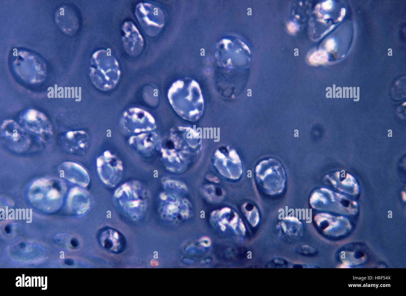 Histology trachea hi-res stock photography and images - Alamy