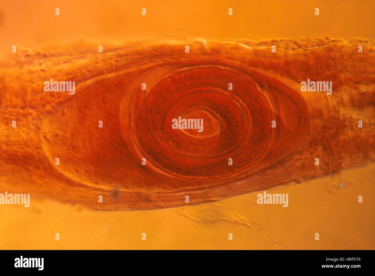 Trichinella spiralis hi-res stock photography and images - Alamy