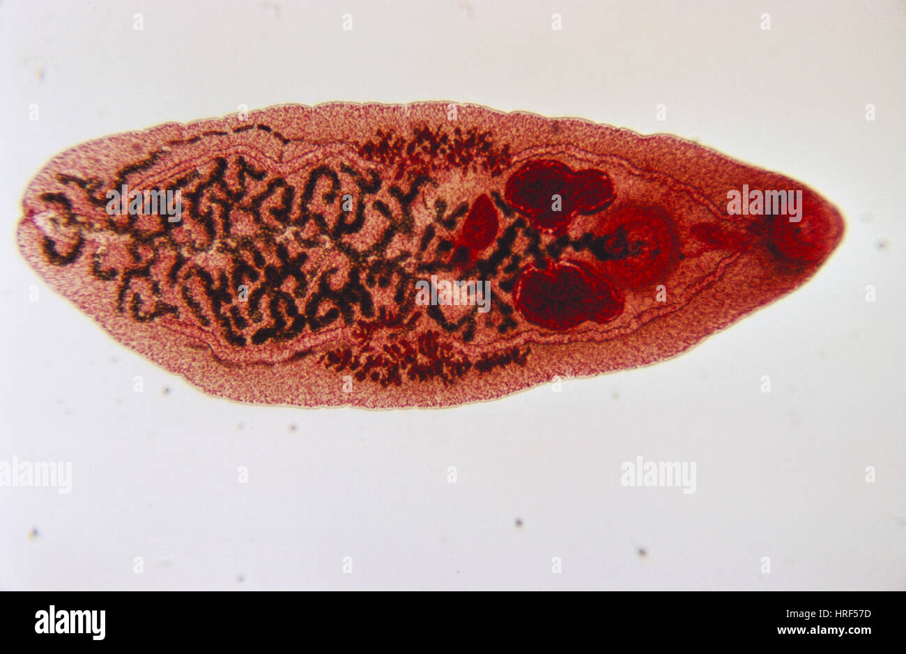 Schistosoma Japonicum Ova