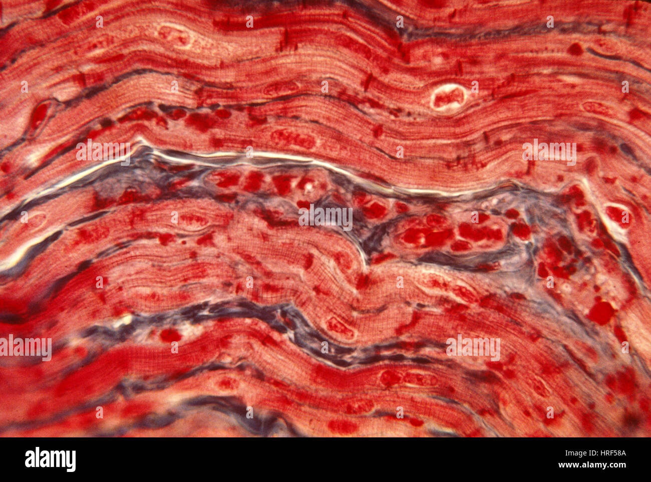 Cardiac muscle tissue hi-res stock photography and images - Alamy