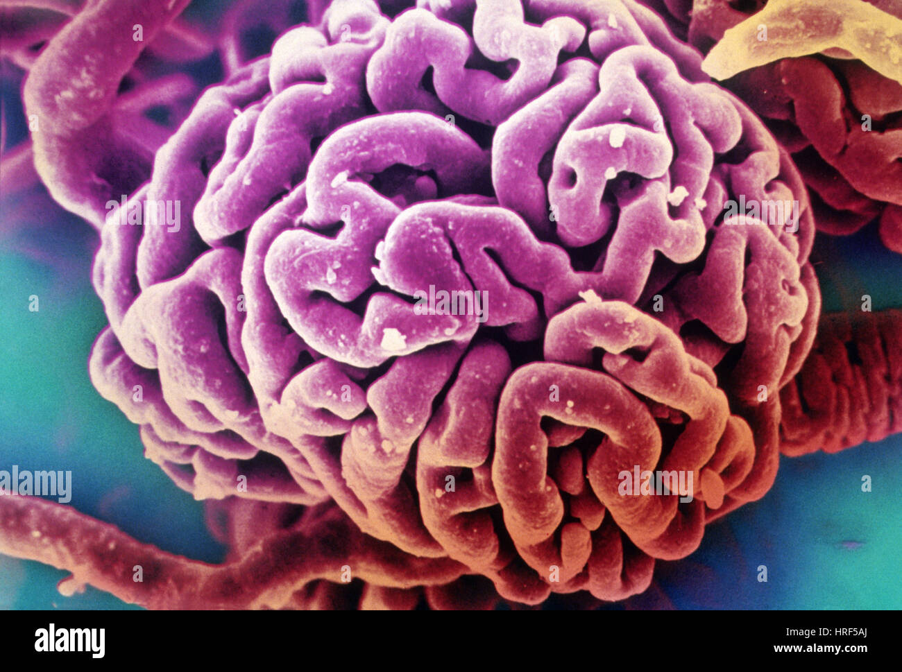 Glomerulus micrograph hi-res stock photography and images - Alamy