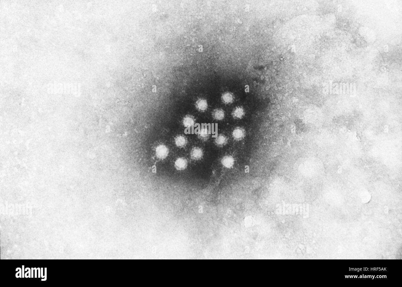 Hepatitis A Virus, TEM Stock Photo - Alamy
