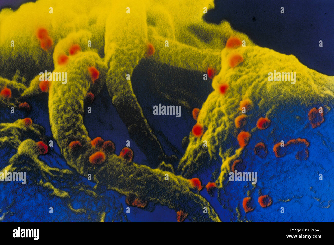 Scanning electron micrograph of hiv 1 hi-res stock photography and ...