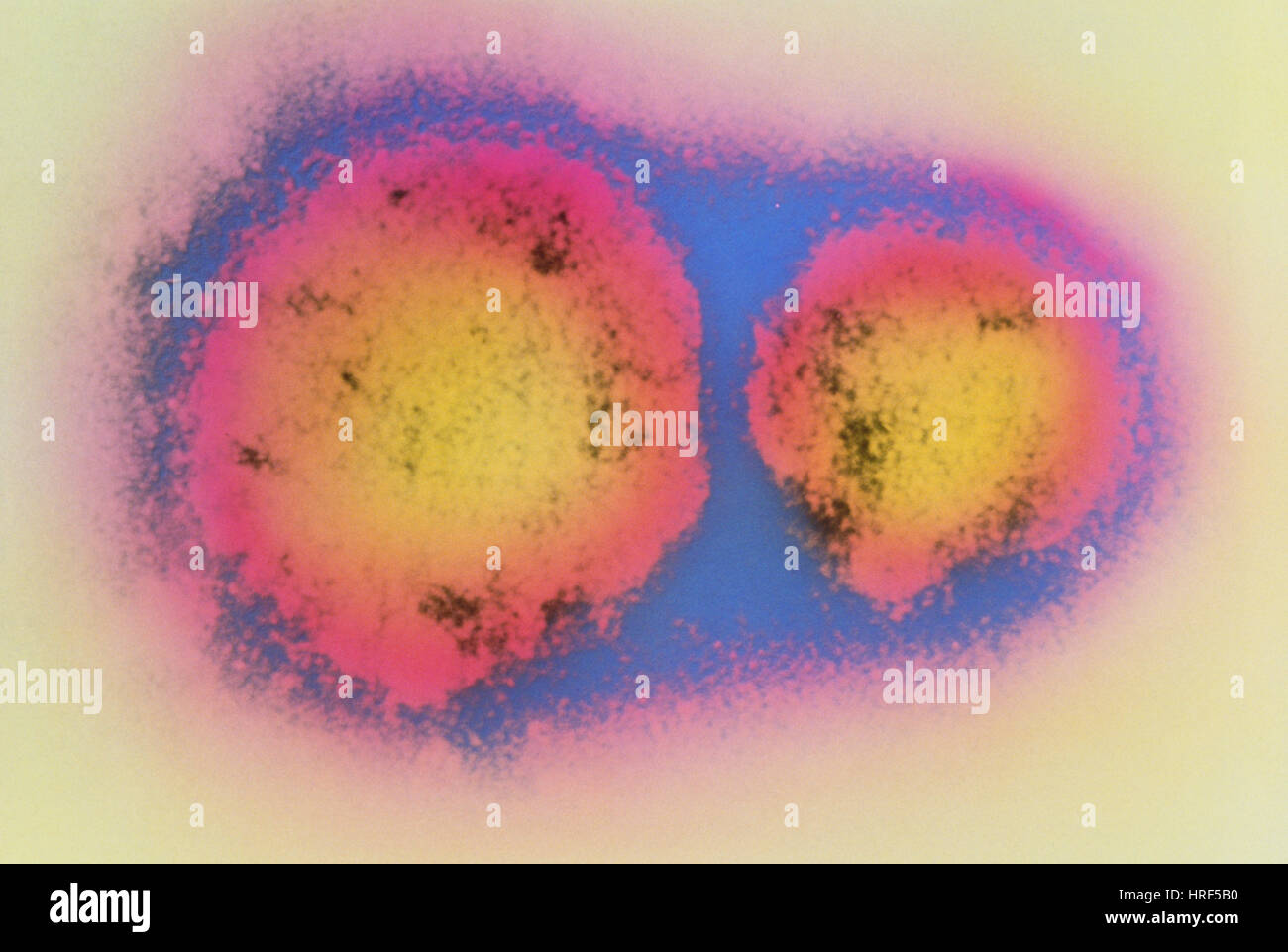 Hantavirus pulmonary syndrome hi-res stock photography and images - Alamy
