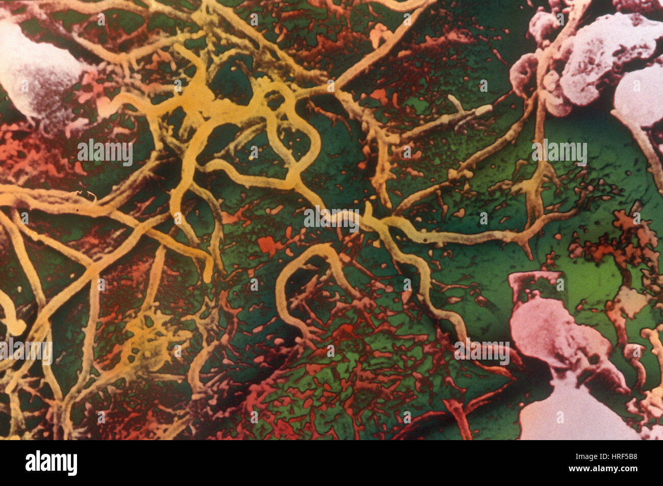 Lyme disease spirochete borrelia burgdorferi hi-res stock photography ...