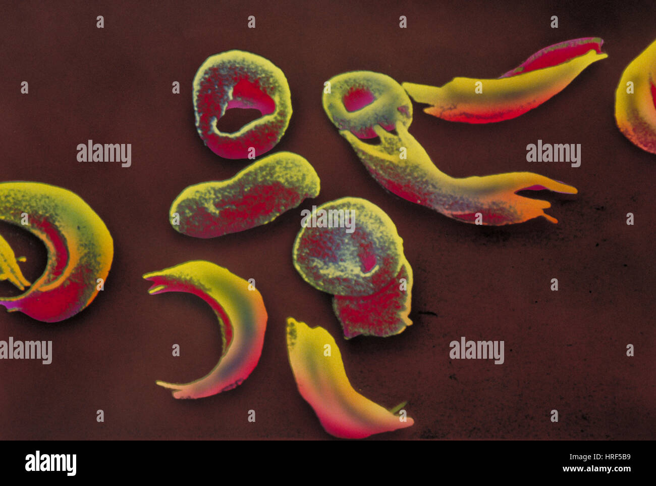 Deformed cell hi-res stock photography and images - Alamy