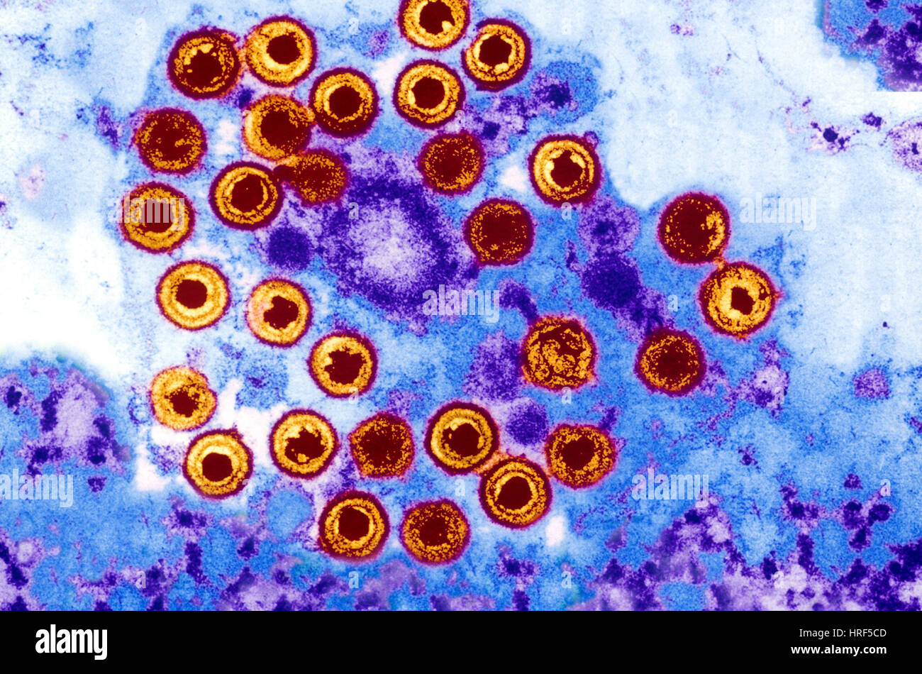 Herpes zoster sore hi-res stock photography and images - Alamy