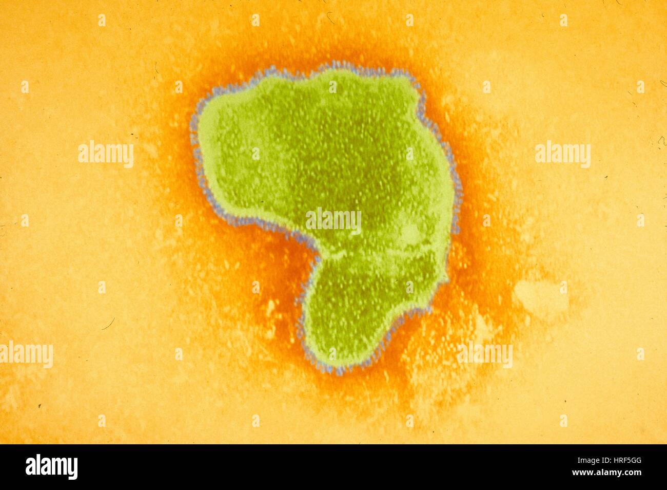Respiratory Syncytial Virus (TEM Stock Photo - Alamy