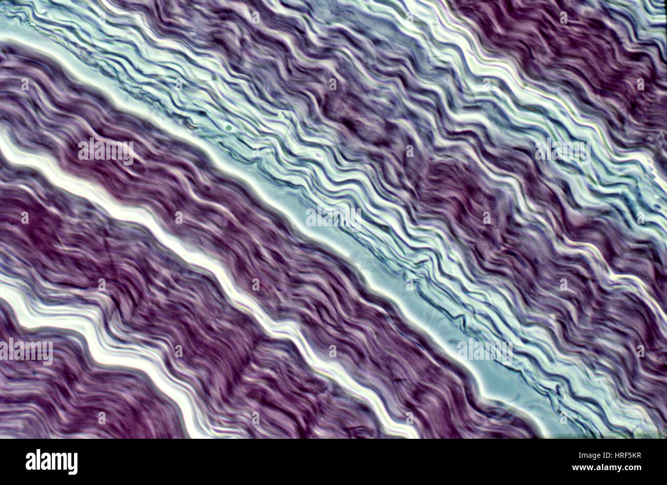 Tendon tissue hi-res stock photography and images - Alamy