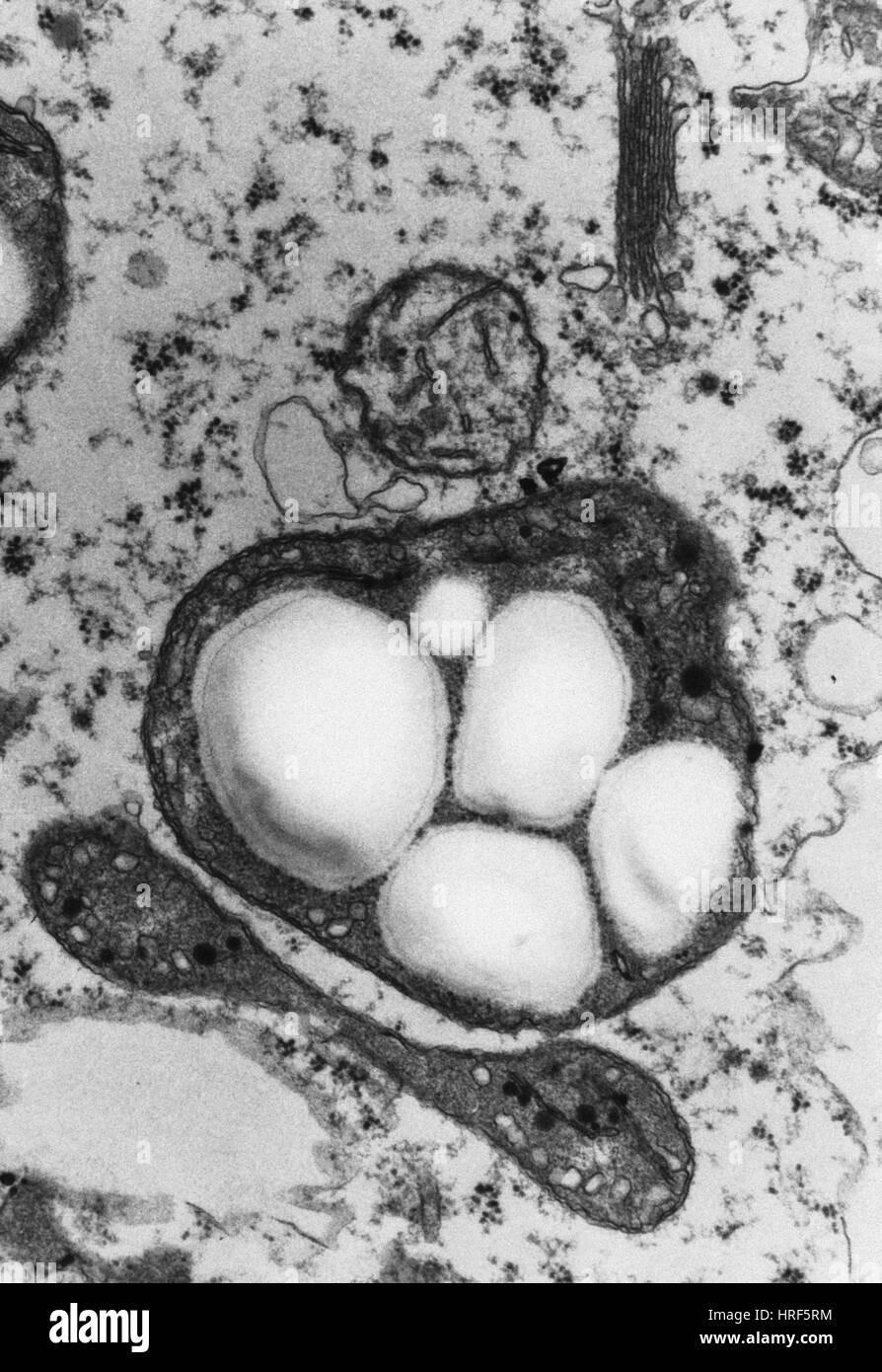 Plant cell tem hi-res stock photography and images - Alamy