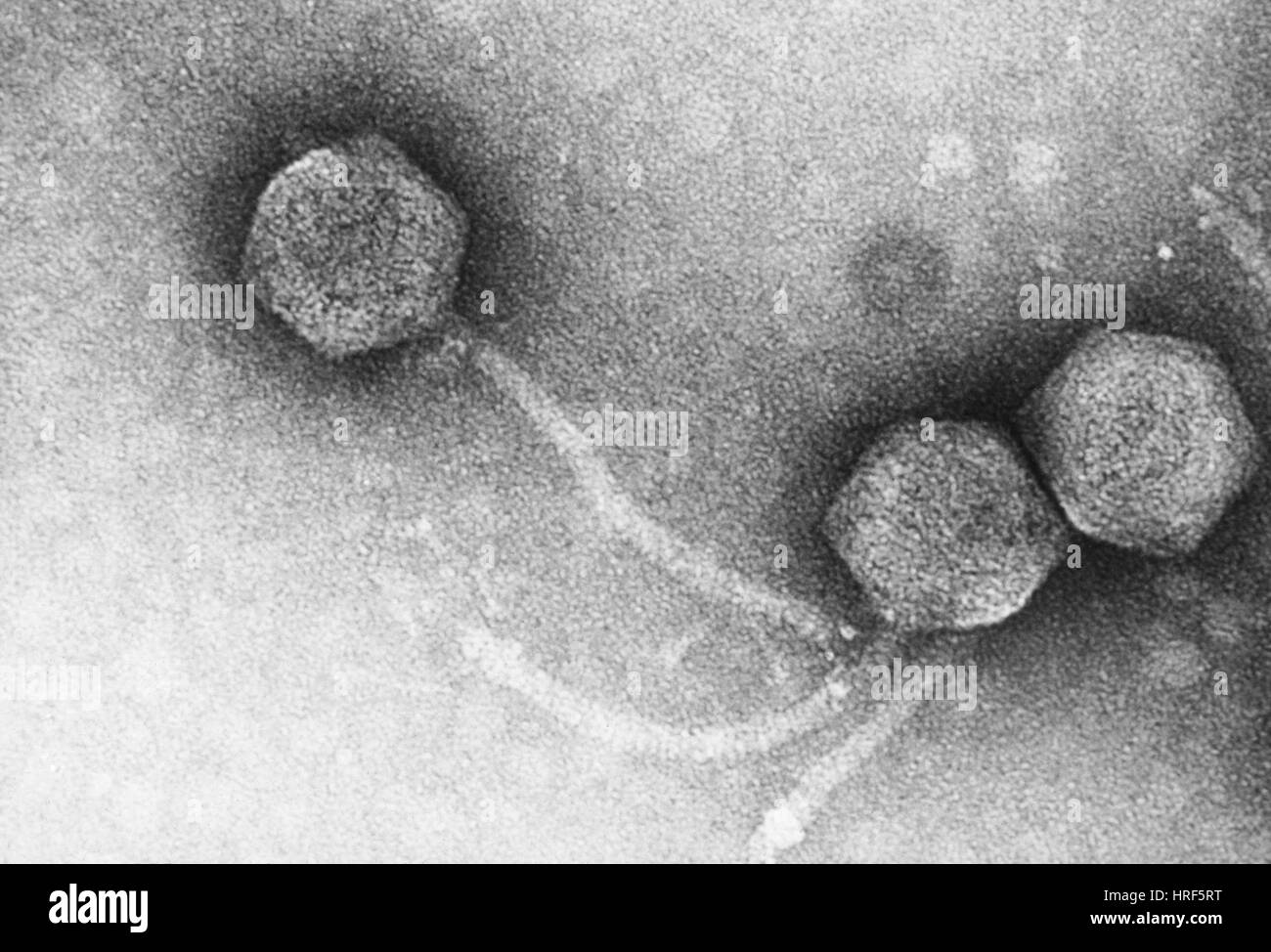 Enteriobacteria phage T5 (TEM Stock Photo - Alamy
