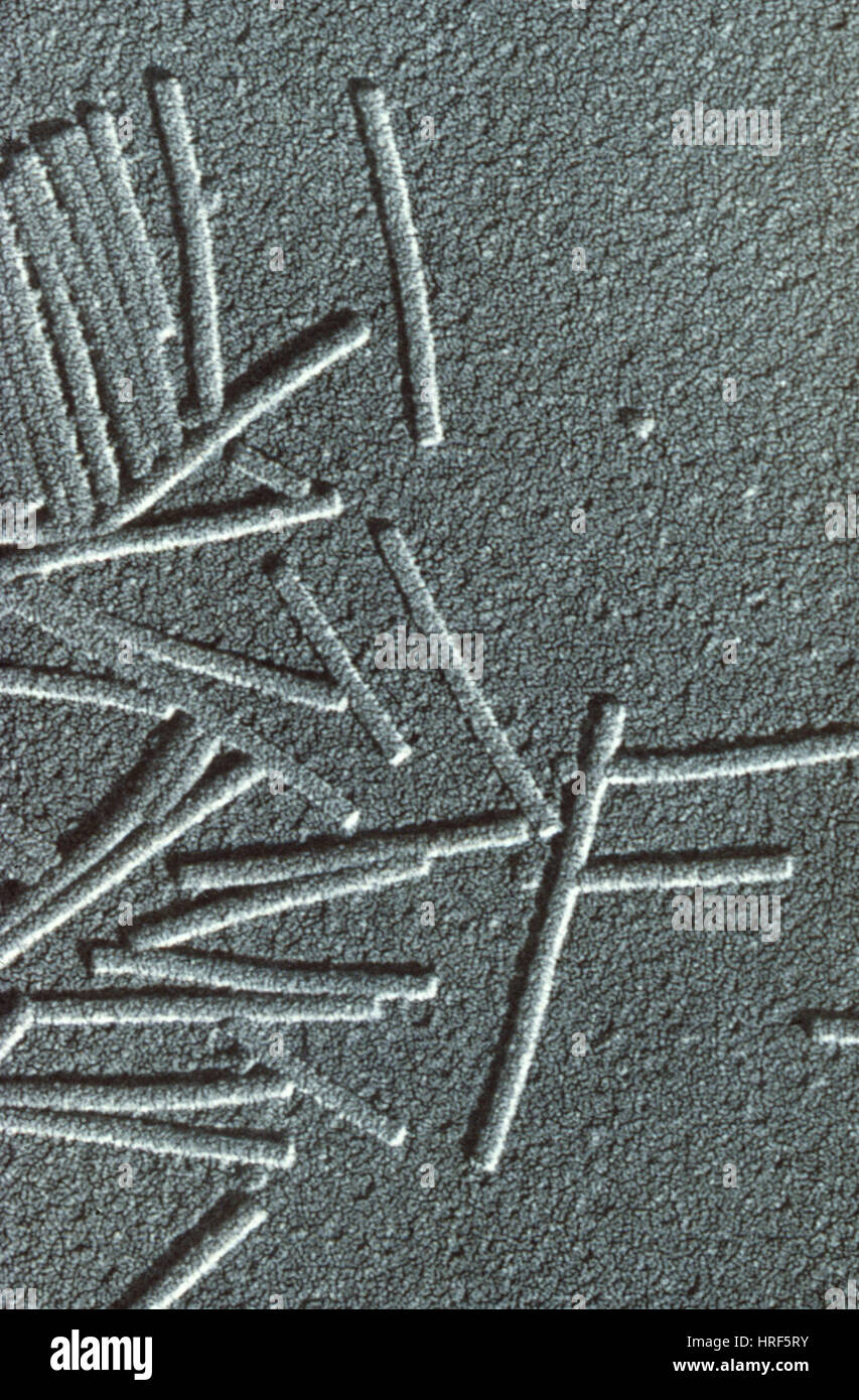 Tobacco mosaic virus micrograph hi-res stock photography and images - Alamy