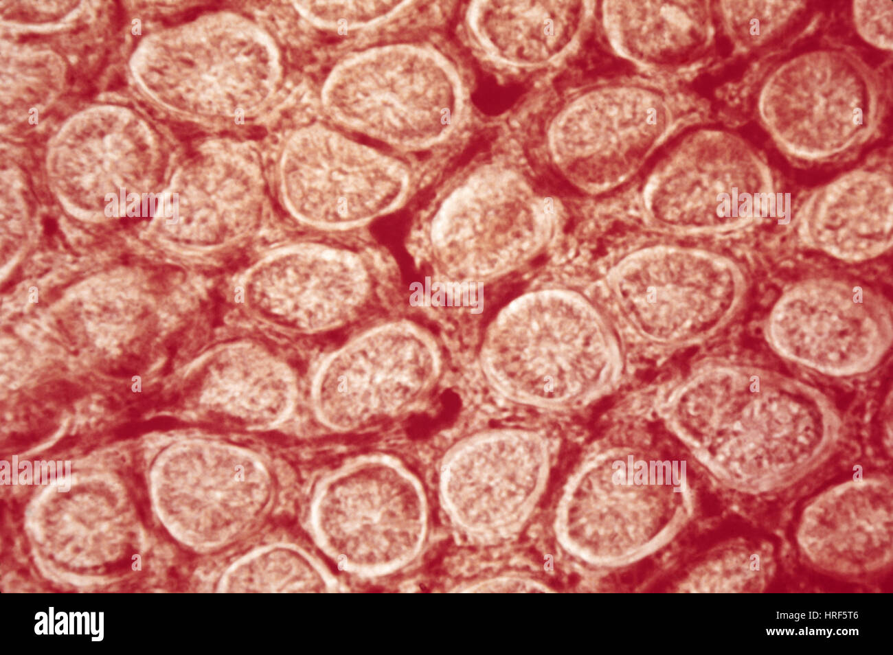 Large intestine histology hi-res stock photography and images - Alamy