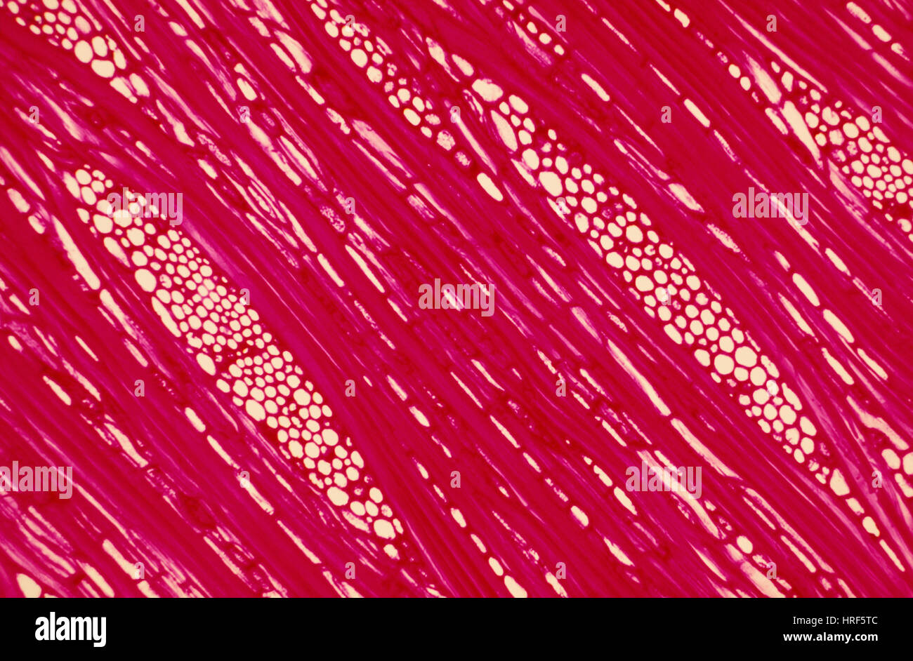 Medullary ray hi-res stock photography and images - Alamy