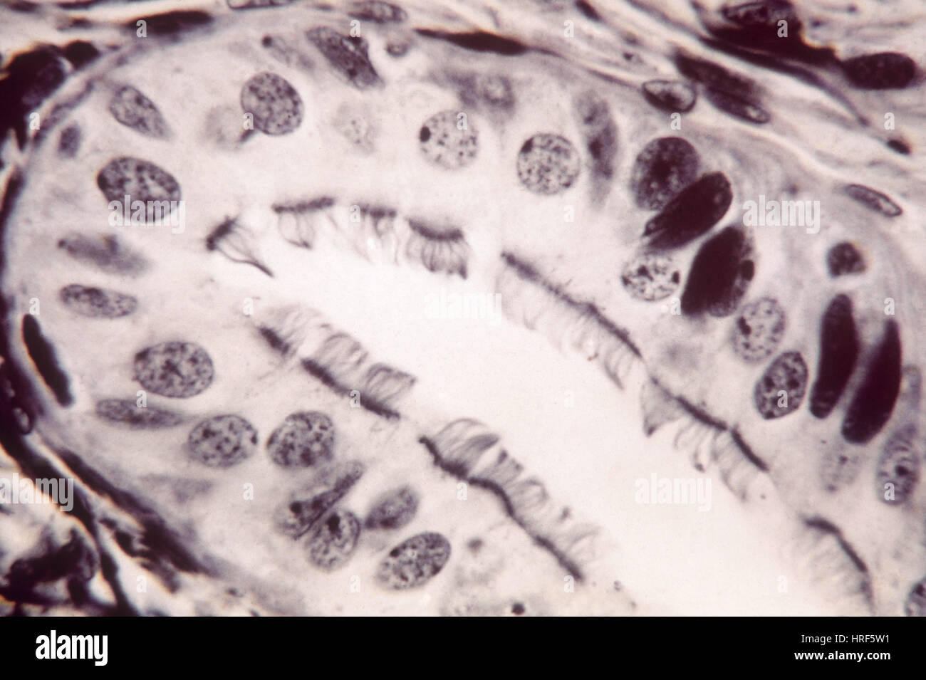 Ovulation micrograph hi-res stock photography and images - Alamy