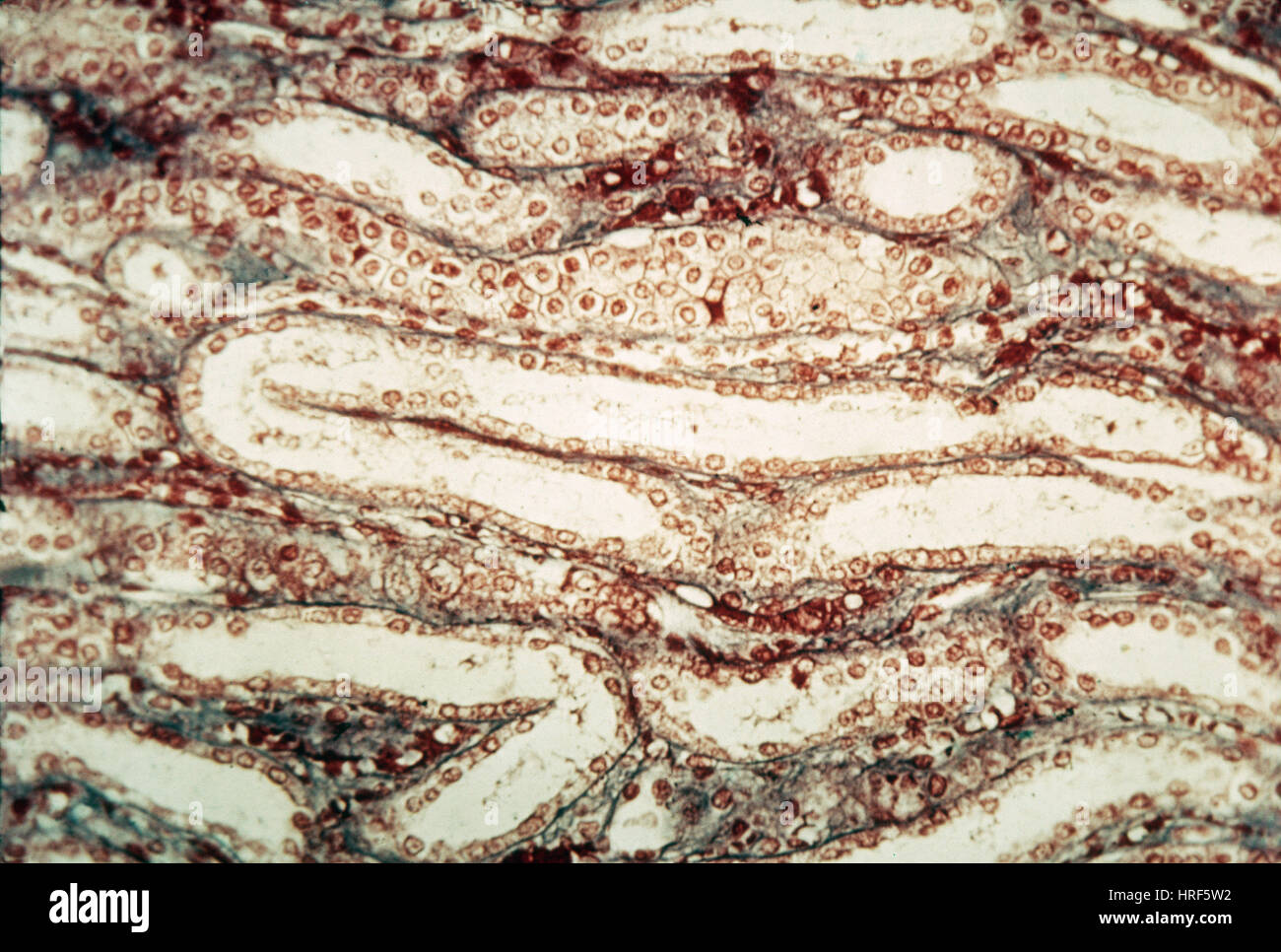 The loop hi-res stock photography and images - Alamy