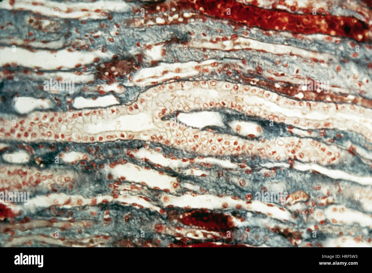 Kidney tubule cell hi-res stock photography and images - Alamy